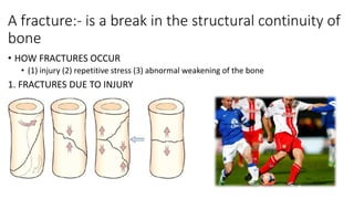 Principles of fracture fixation | PPTX
