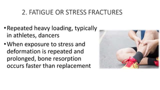 Principles of fracture fixation | PPTX