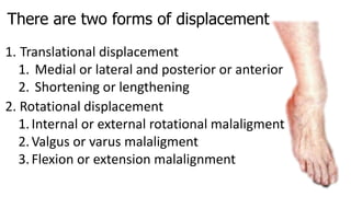 Principles of fracture fixation | PPT