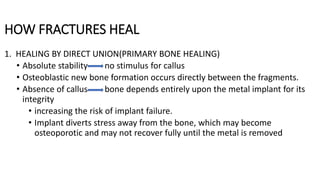Principles of fracture fixation | PPTX