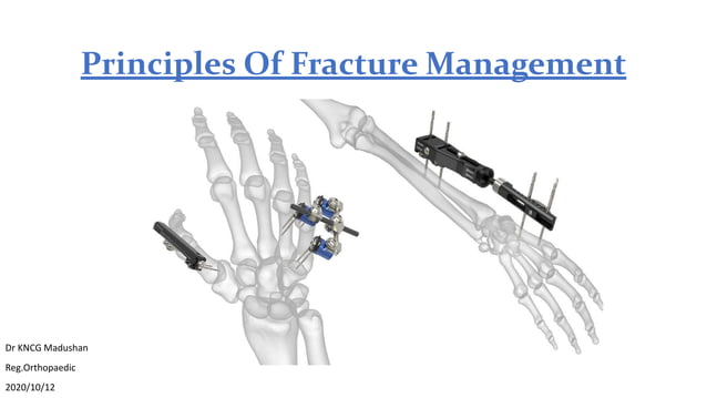 Principles of fracture fixation