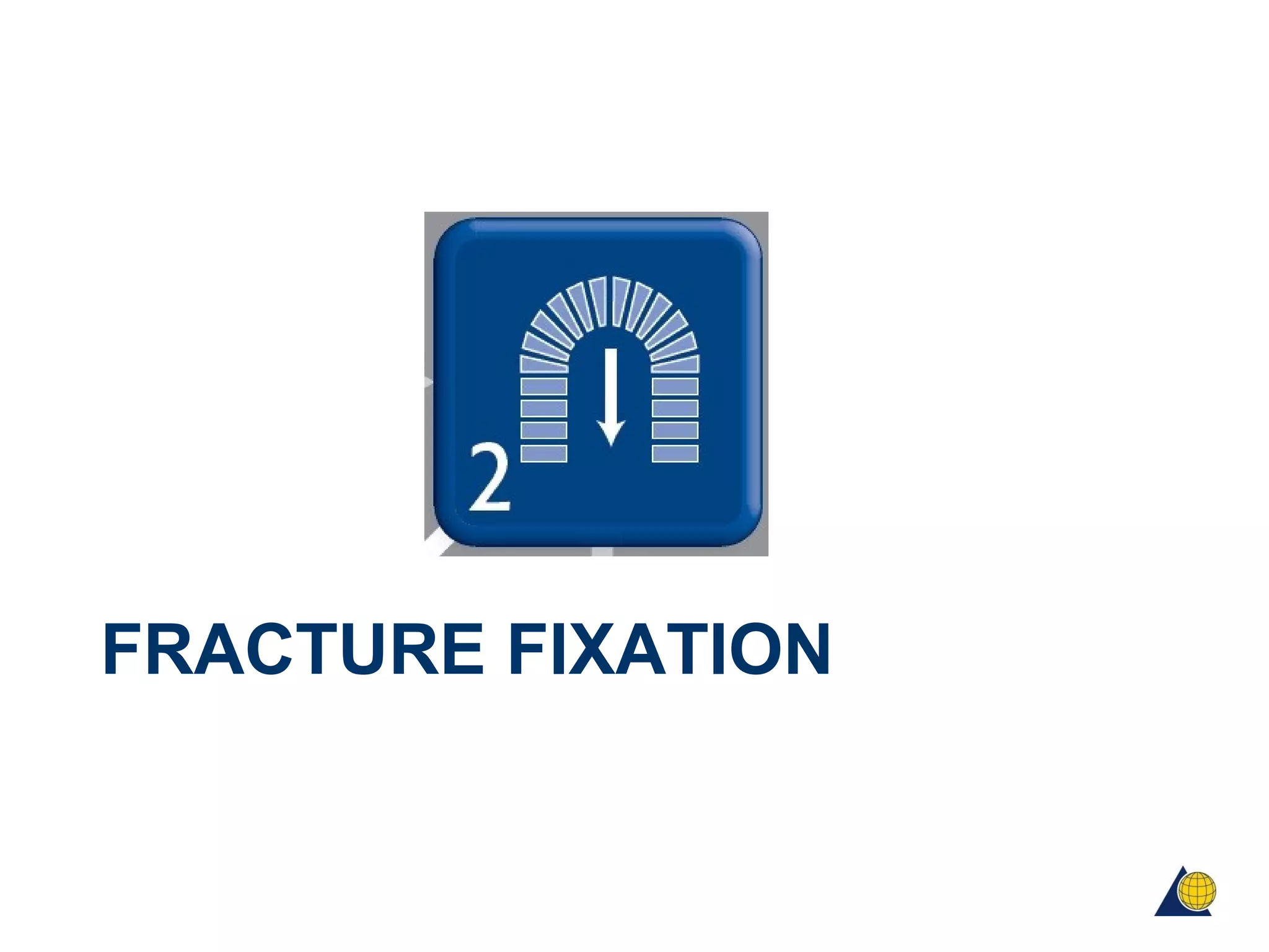 Principles of fracture fixation | PPT