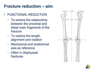 Principles of fracture fixation | PPT