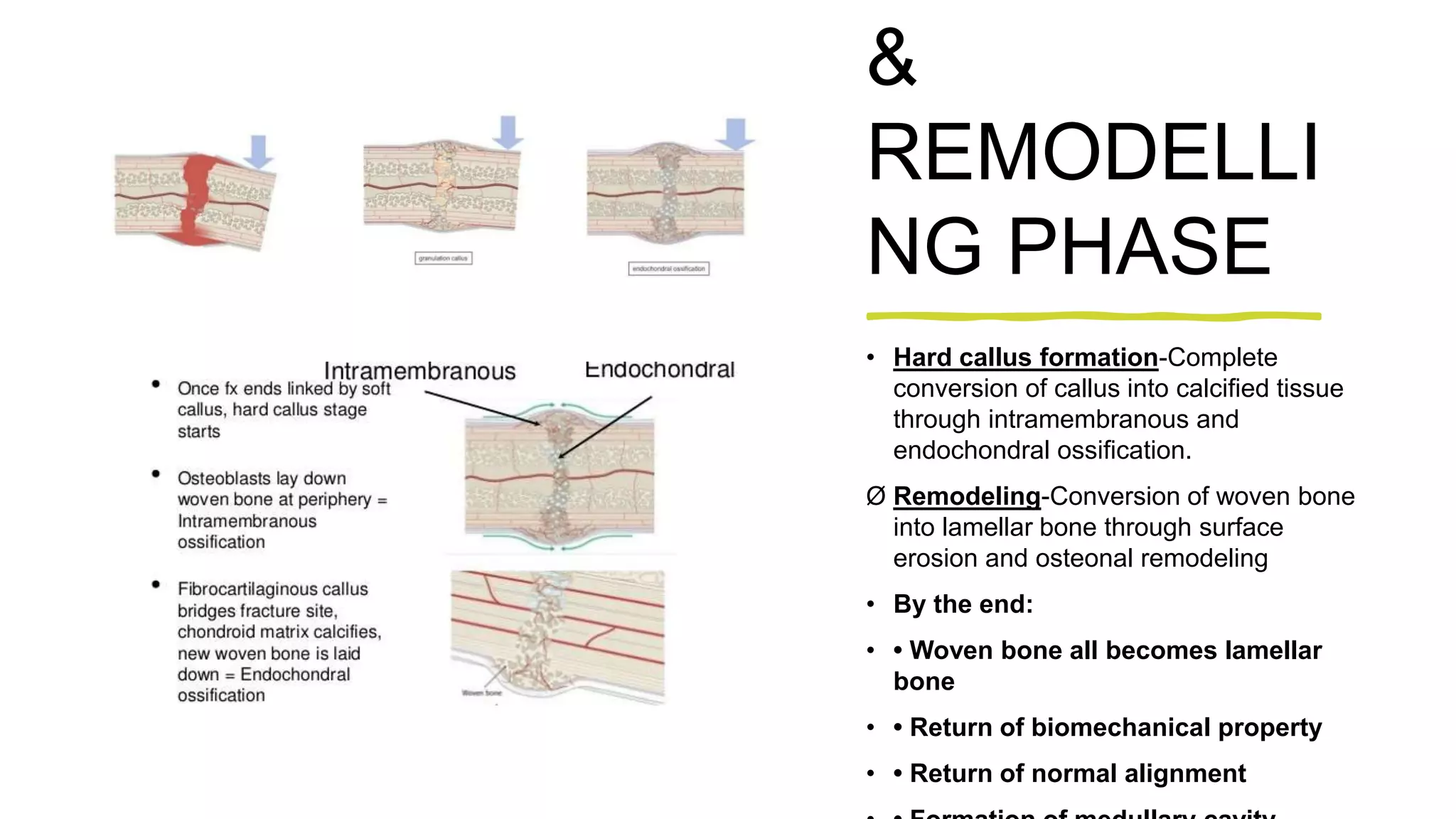 Principles of fracture healing | PPTX