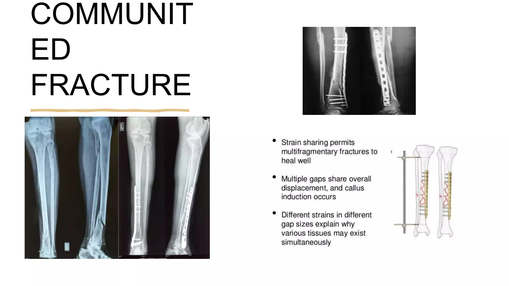 Principles of fracture healing | PPTX