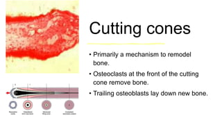 Principles of fracture healing | PPTX