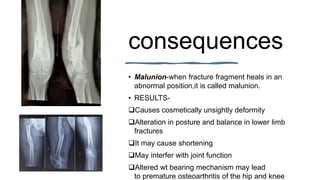 Principles of fracture healing | PPTX