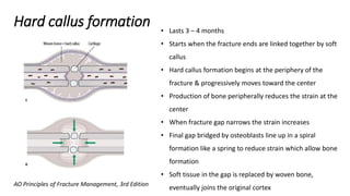 Principles of Fracture Management for General Surgeons.pptx
