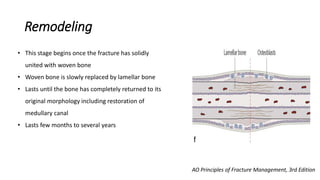 Principles of Fracture Management for General Surgeons.pptx