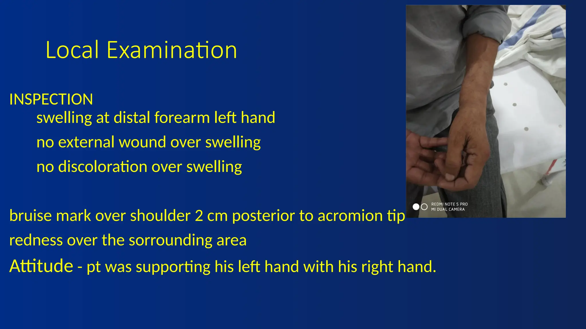 principles of fracture management by plaster cast.pptx