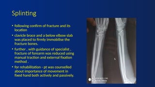 principles of fracture management by plaster cast.pptx