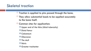 Principles of Fracture Management orthopedics | PPT