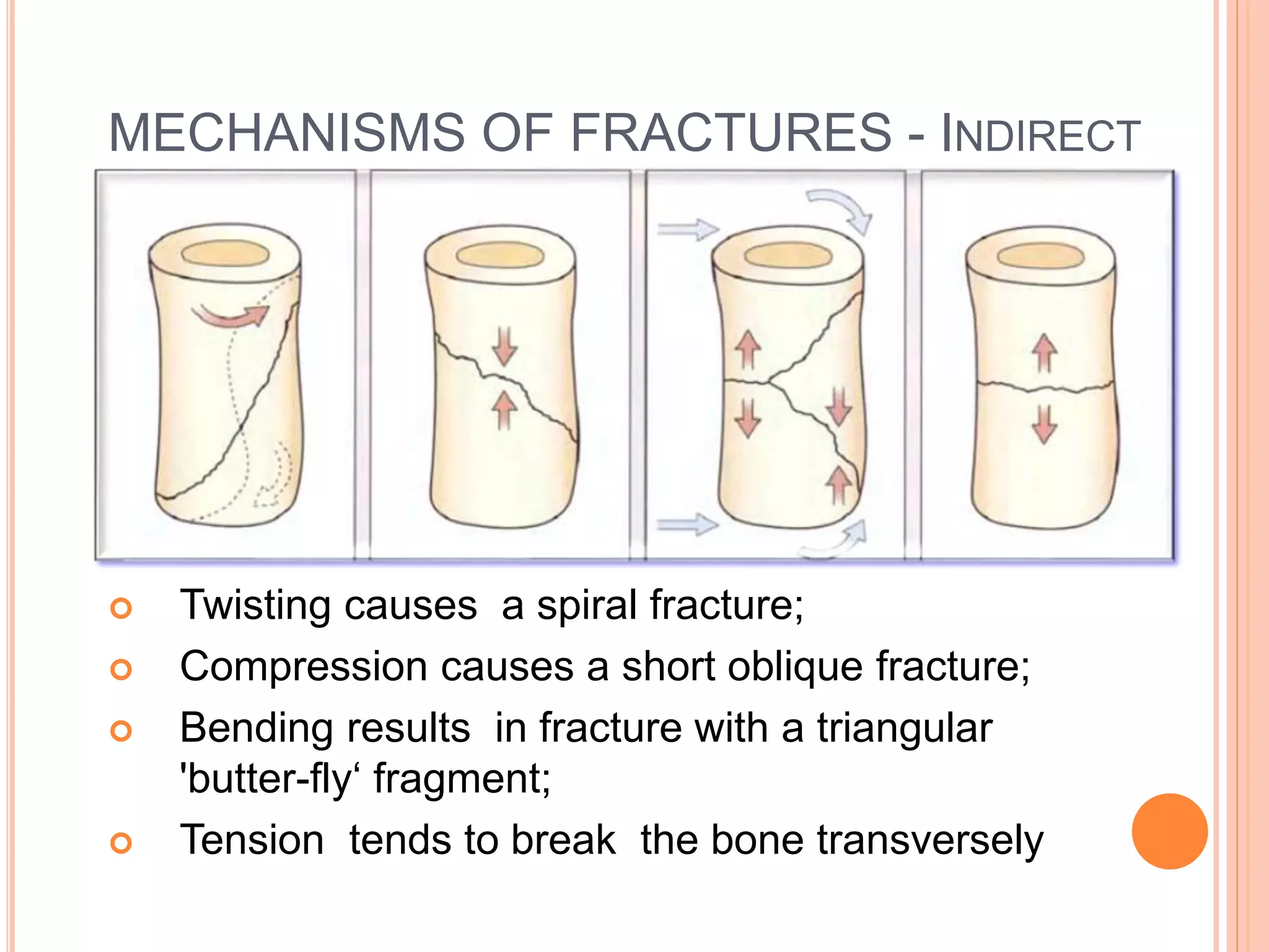 Principles of fracture management Saseendar | PPSX