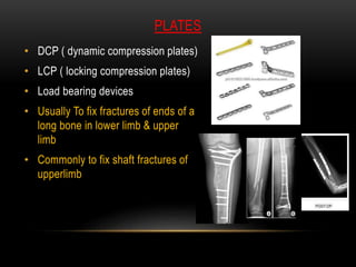 Principles of fracture managemnet | PPTX