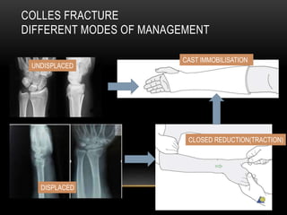 Principles of fracture managemnet | PPTX