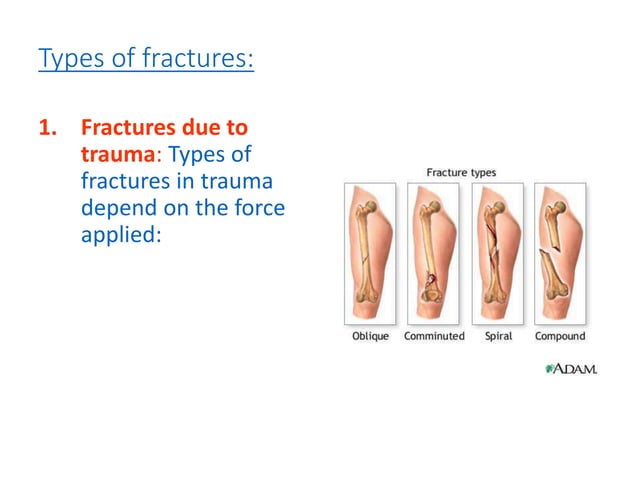 Principles_of_fractures-1.ppt