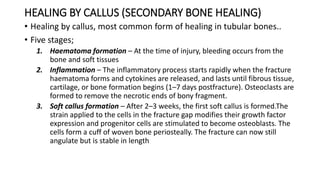 Principles of fractures.pptx