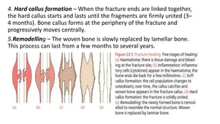 Principles of fractures.pptx