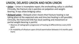 Principles of fractures.pptx