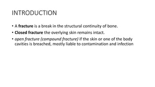 Principles of fractures.pptx