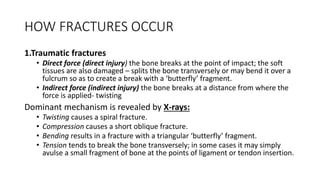 Principles of fractures.pptx