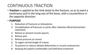 Principles of fractures.pptx