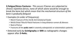 Principles of fractures.pptx