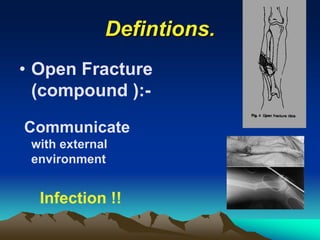Principles of fractures on orthopedic field | PPT