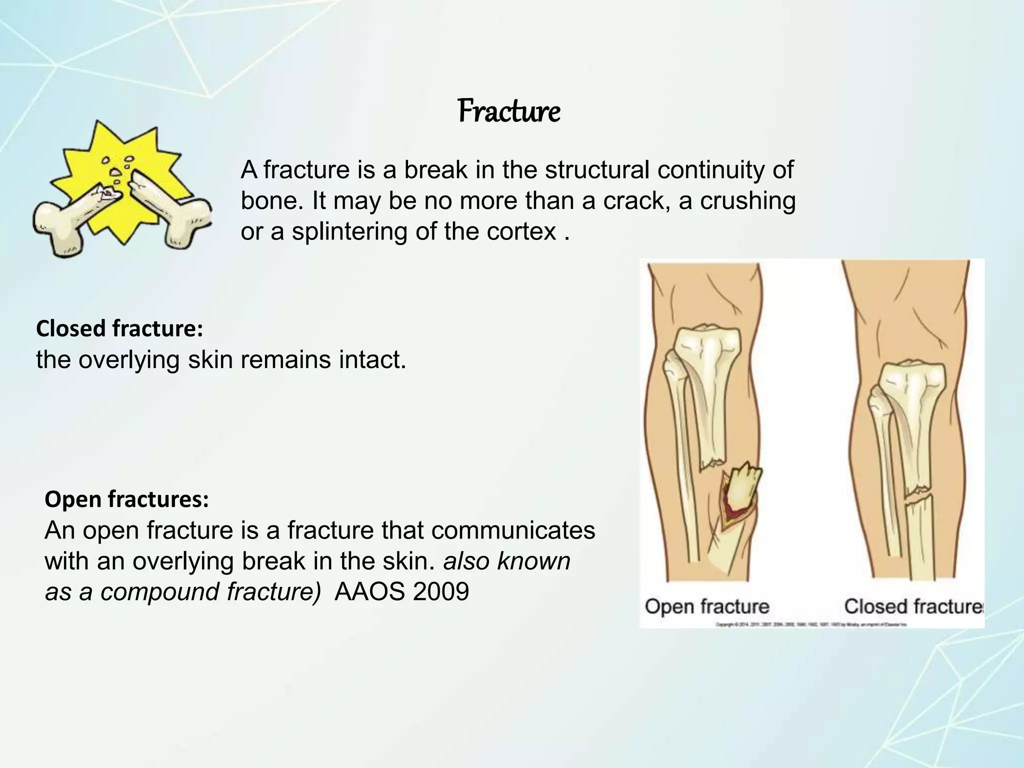 Principles of fractures management | PPTX