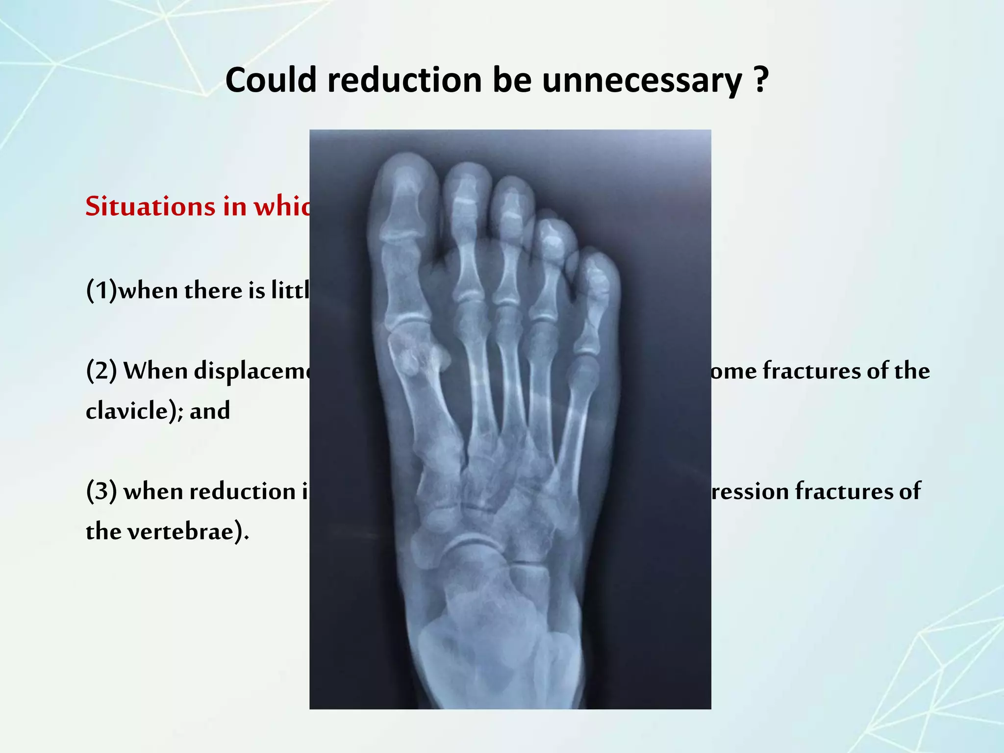 Principles of fractures management | PPTX