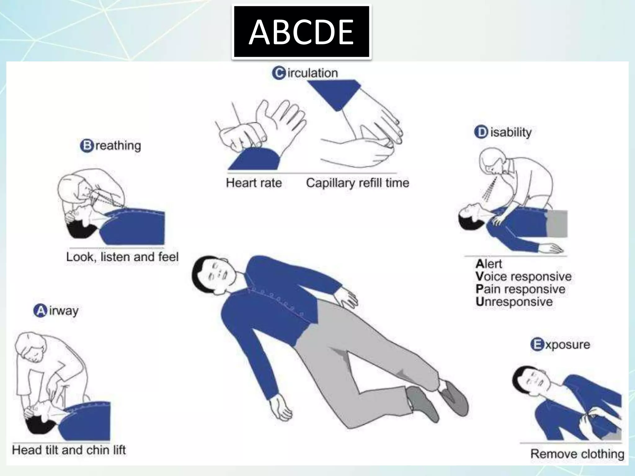 Principles of fractures management | PPTX