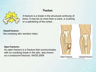 Principles of fractures management | PPTX