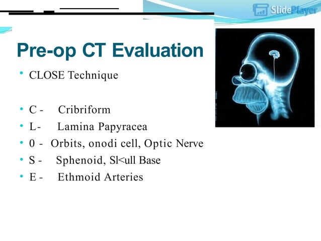 Principles of Functional Endoscopic Sinus Surgery - ppt video online ...