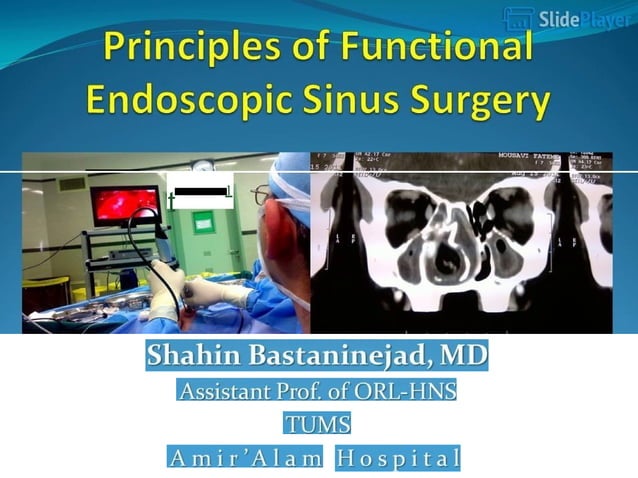 Principles of Functional Endoscopic Sinus Surgery - ppt video online ...