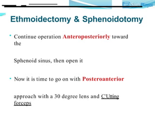 Principles of Functional Endoscopic Sinus Surgery - ppt video online ...