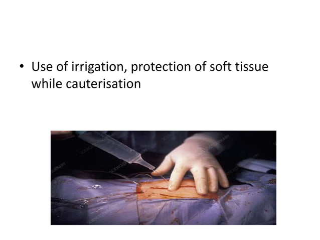 Principles of general surgery | PPTX | First Aid | Injuries