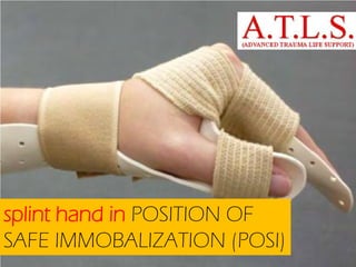 Principles of hand surgery | PDF