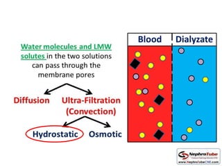 Hemodialysis Diffusion