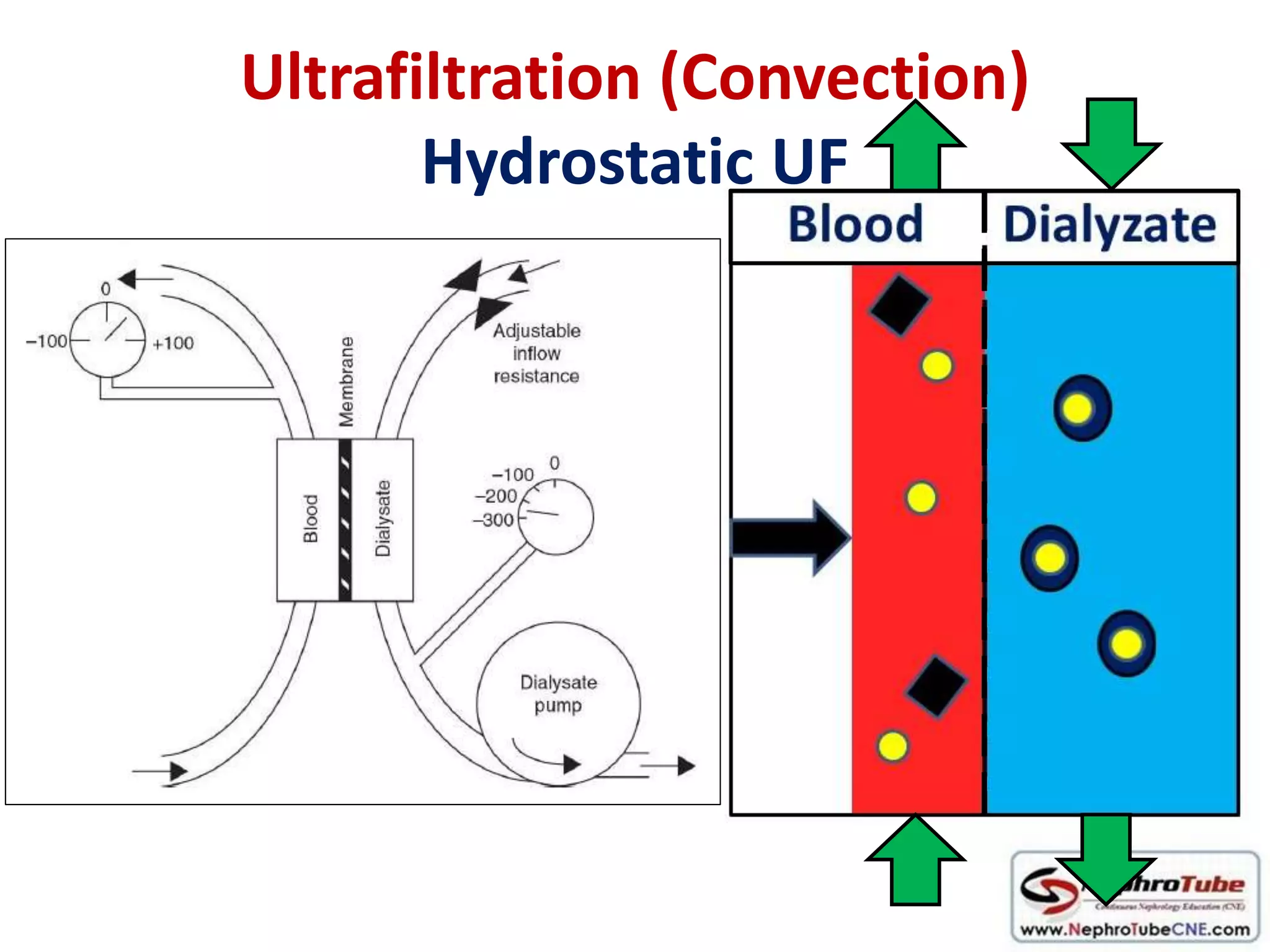 Physiological Principles of Hemodialysis - (An link for an update of ...