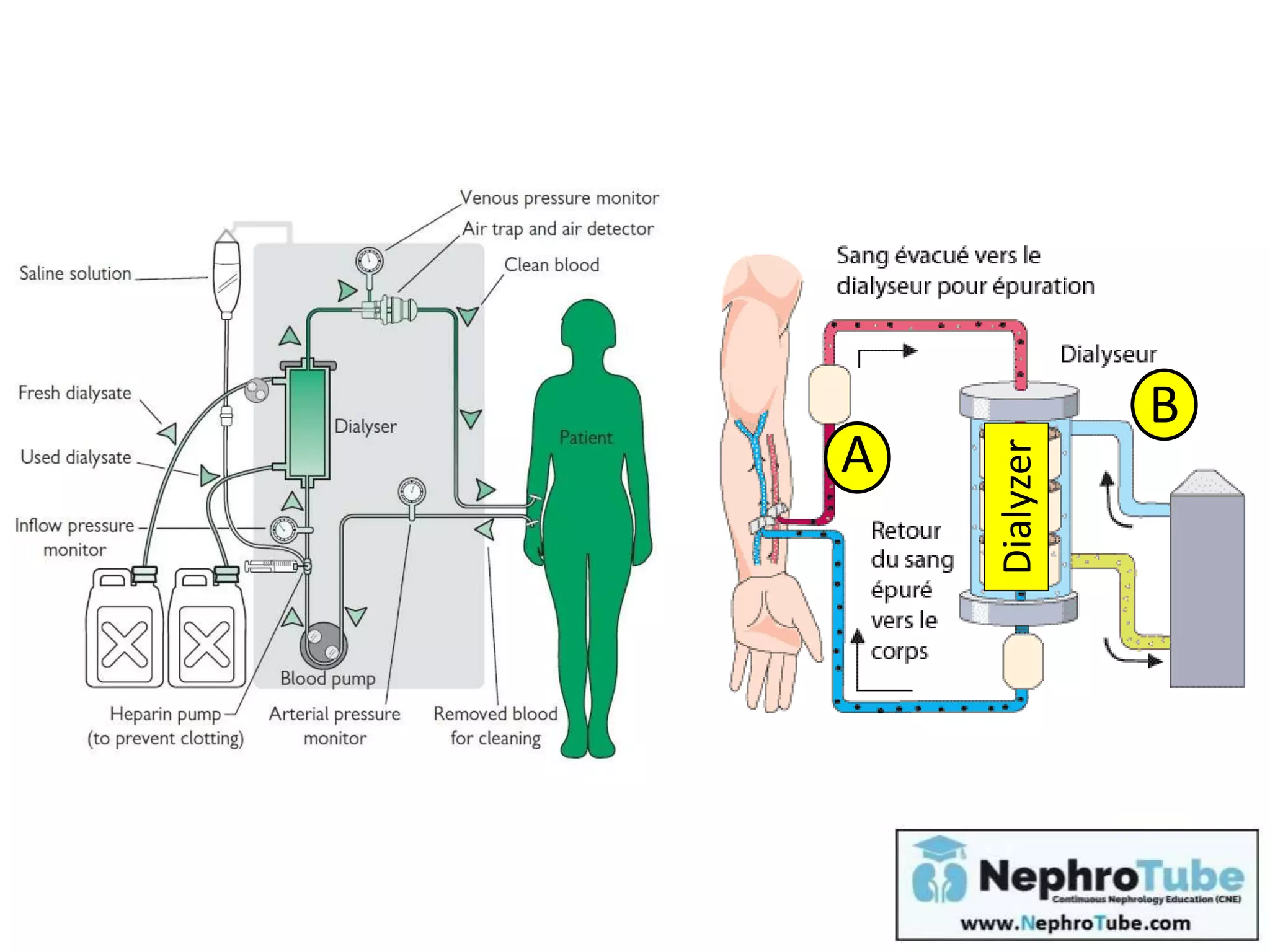 Physiological Principles of Hemodialysis - (An link for an update of ...