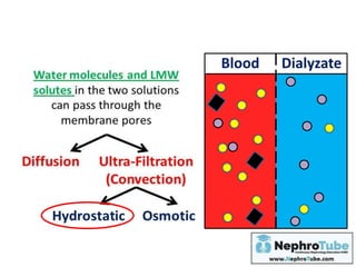 Physiological Principles of Hemodialysis - (An link for an update of ...