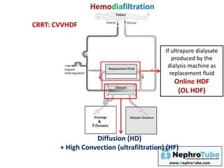 Physiological Principles of Hemodialysis - (An link for an update of ...