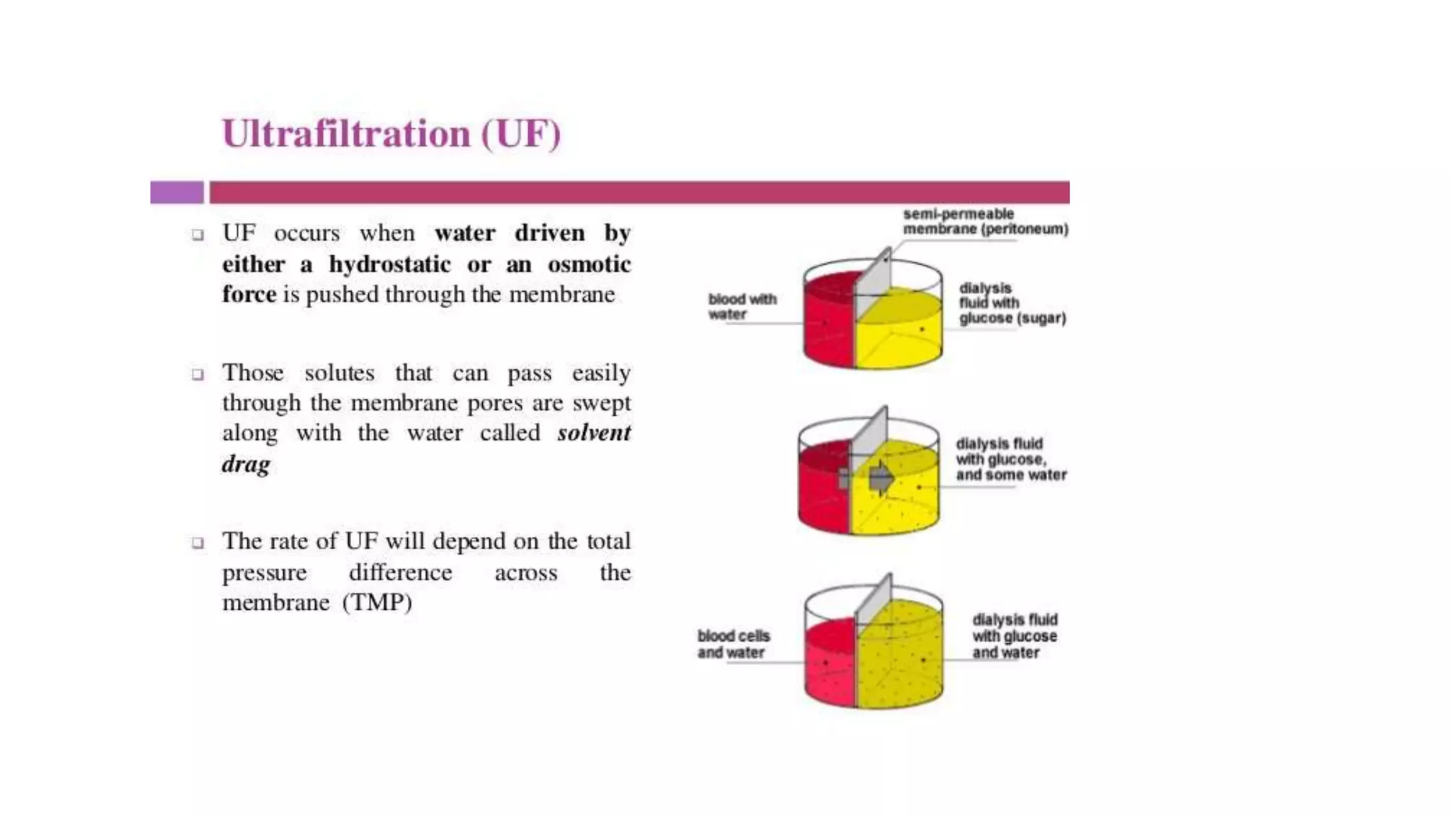 Principles of hemodialysis | PPTX