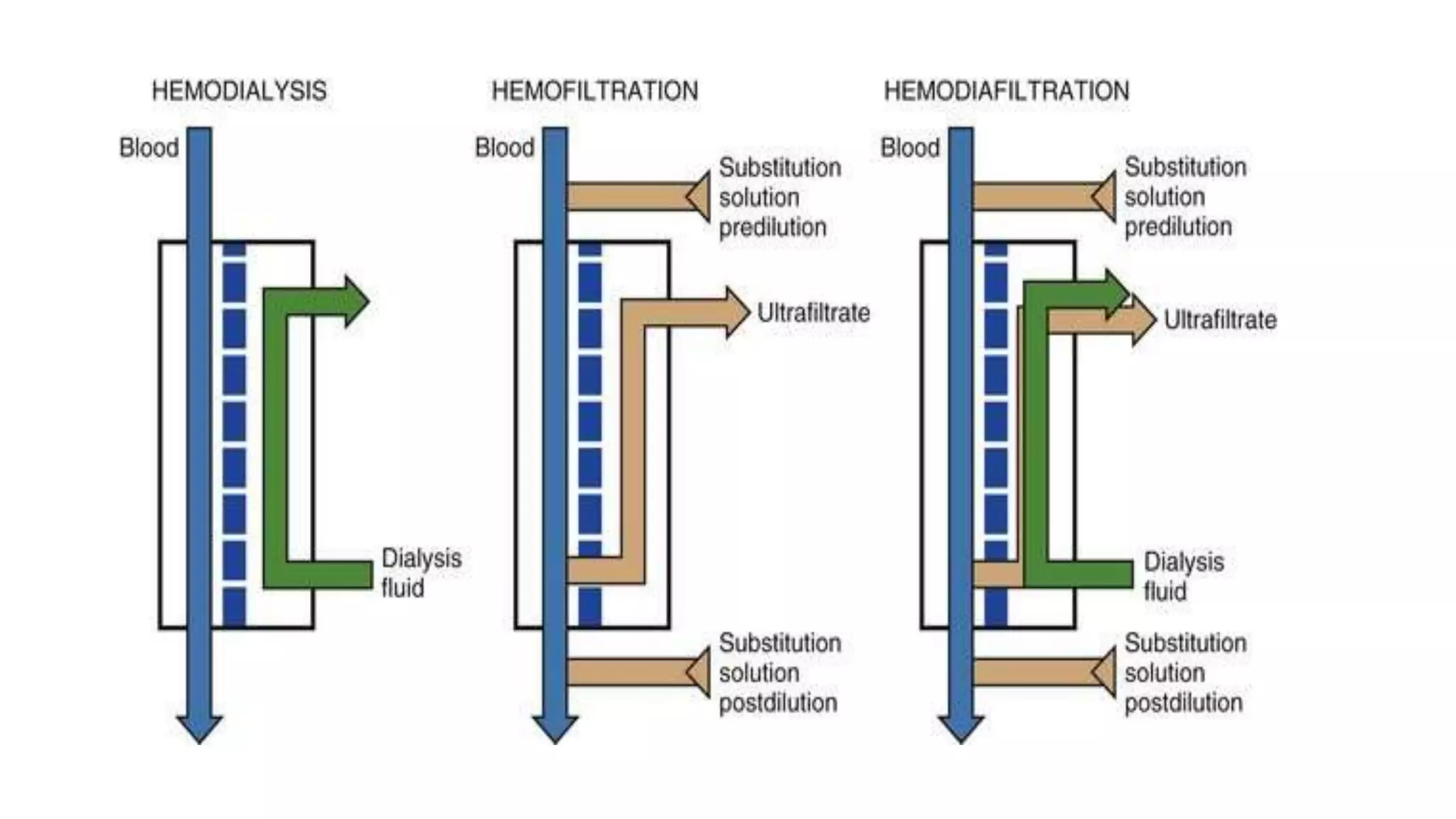 Principles of hemodialysis | PPTX