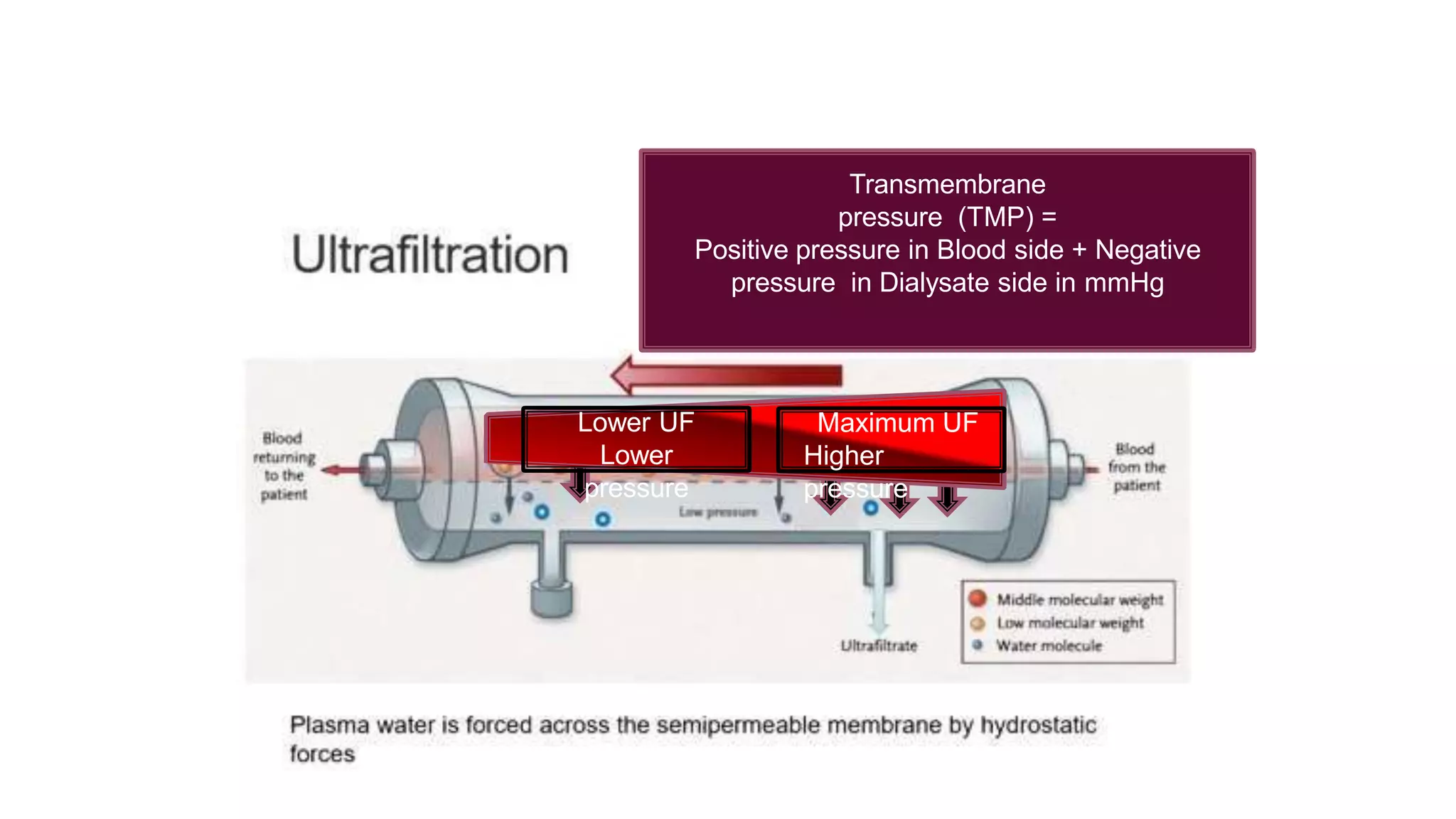 Principles of hemodialysis | PPTX