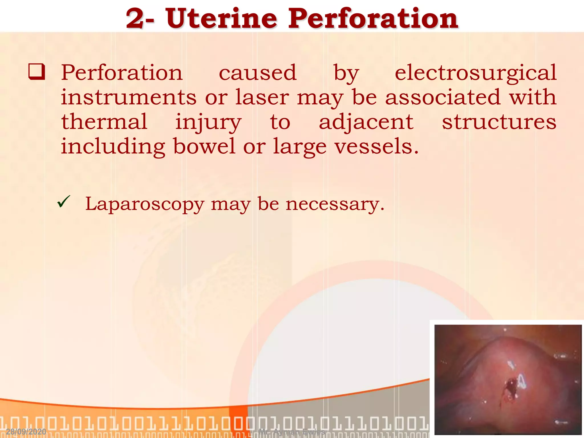 Dr Ayman Ewies - Principles of Hysteroscopy | PDF | Reproductive Health ...