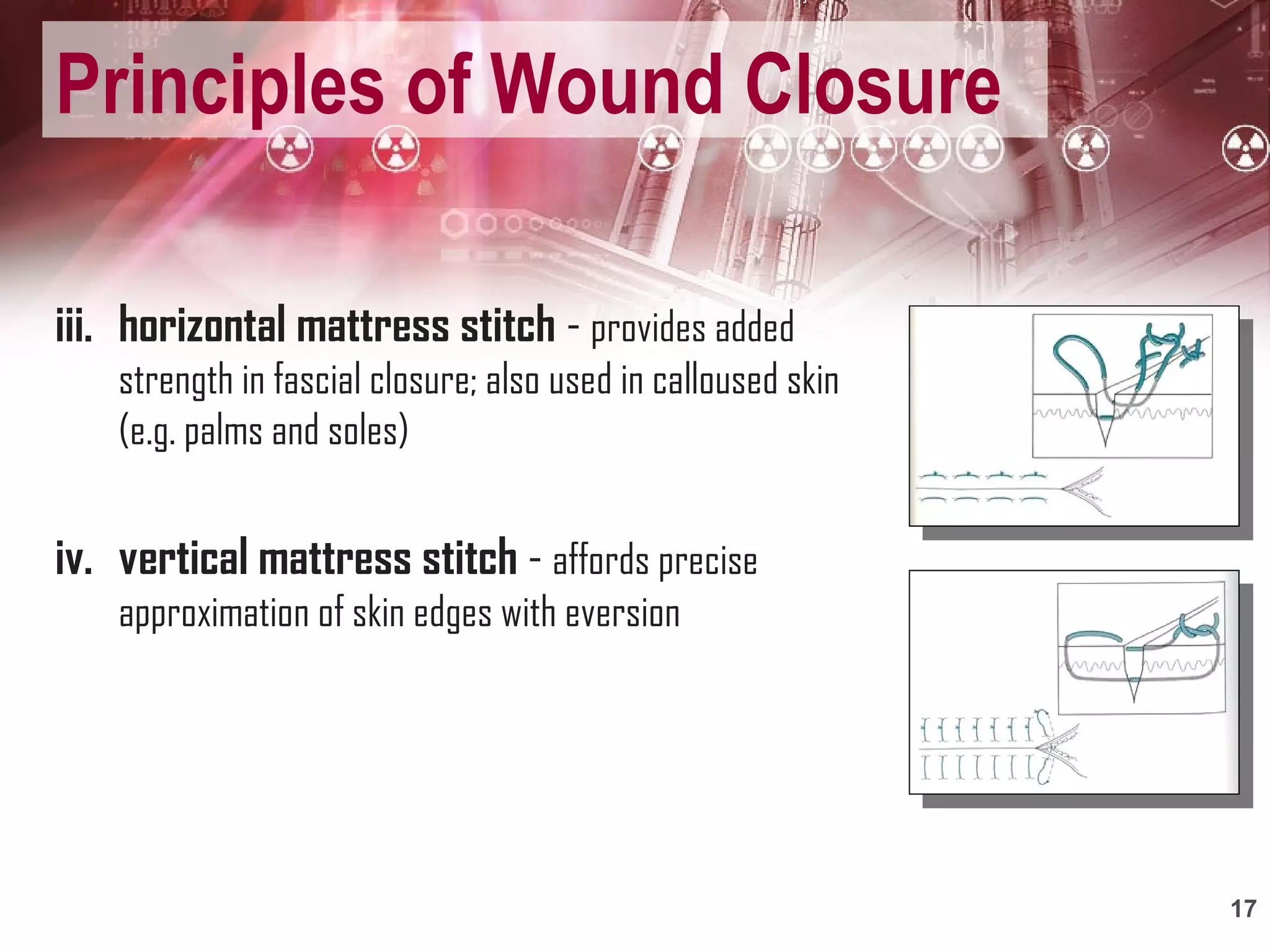 Principles of incision and wound closure | PPT