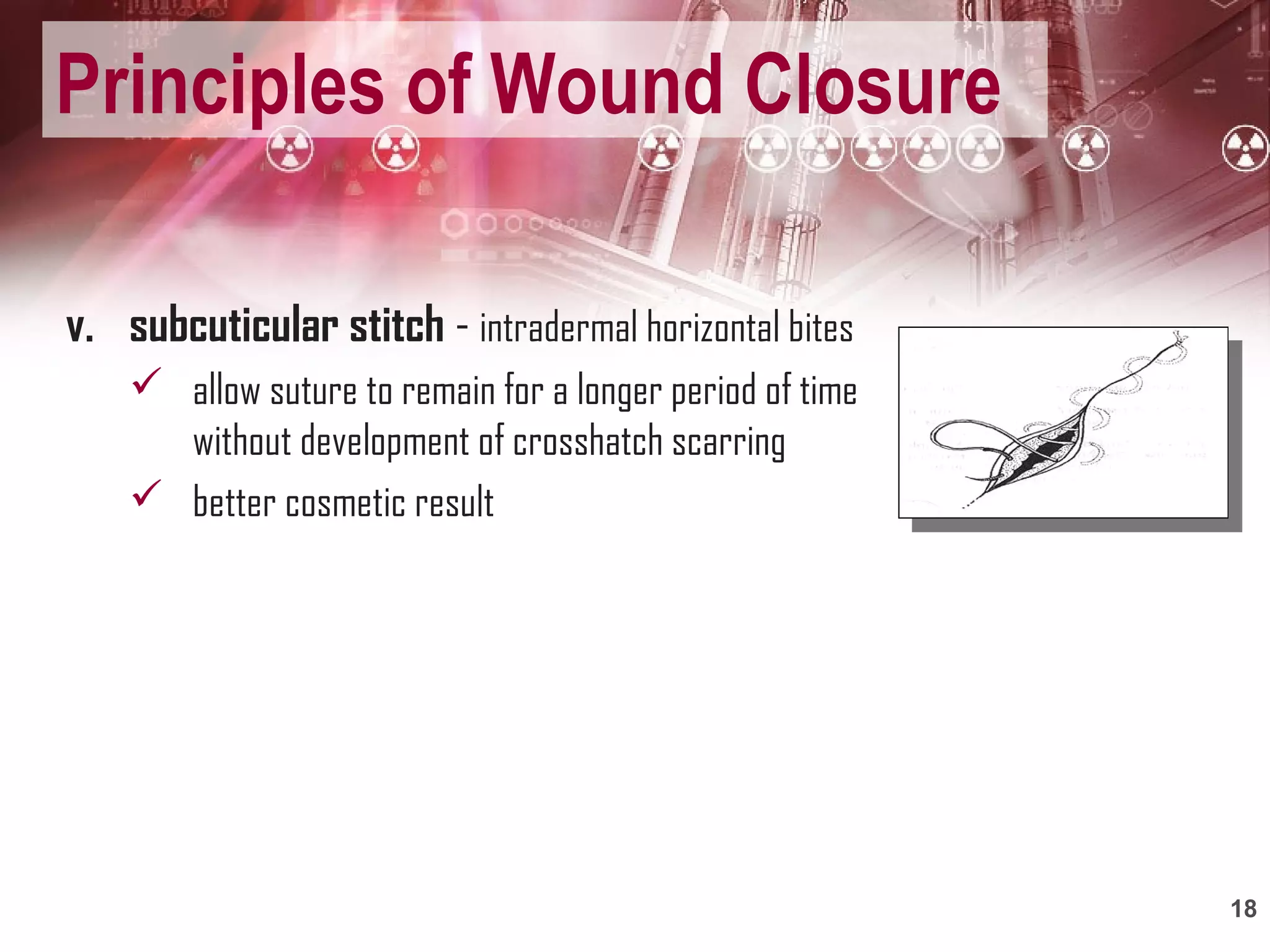 Principles of incision and wound closure | PPT