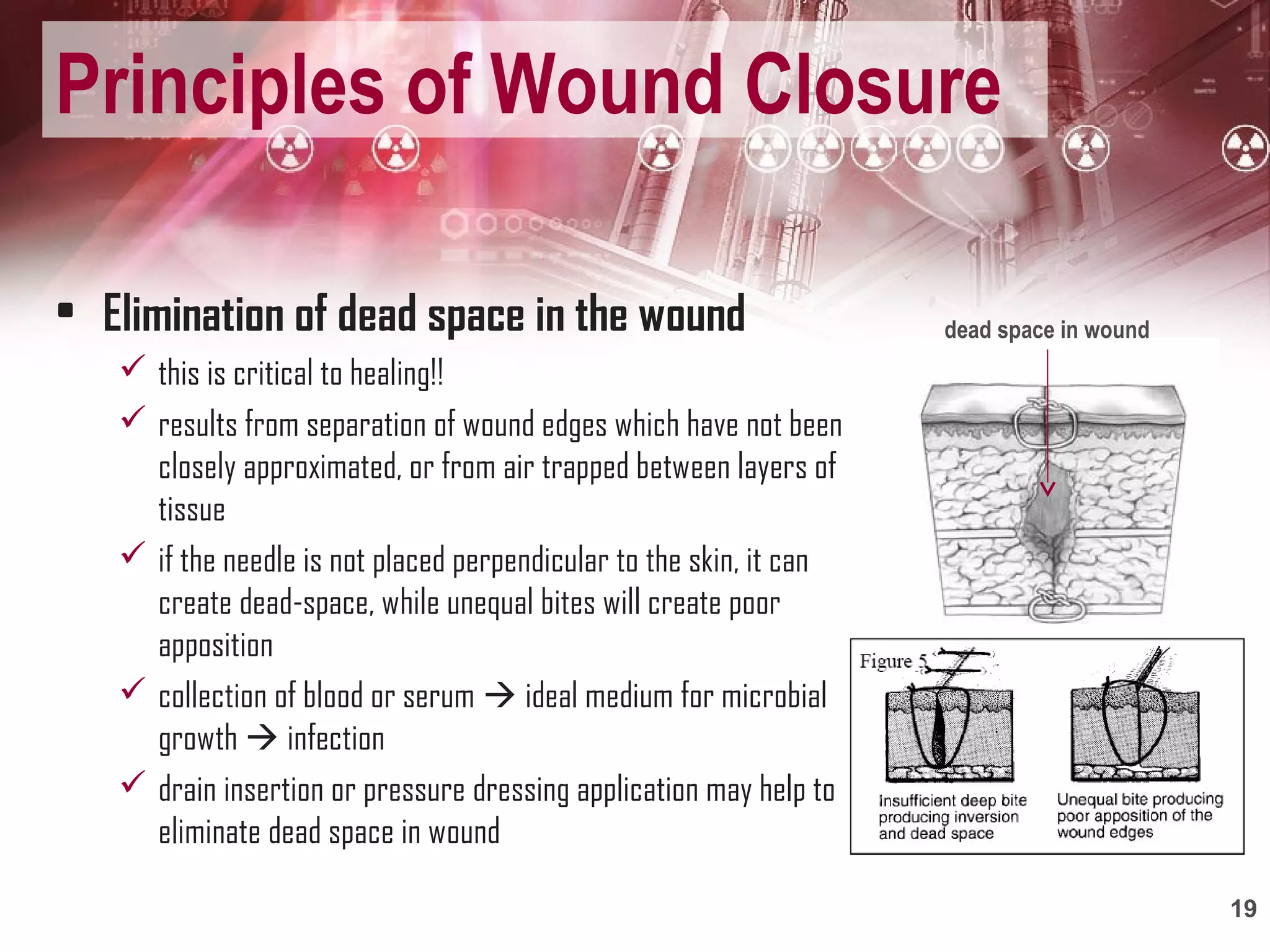 Principles of incision and wound closure | PPT