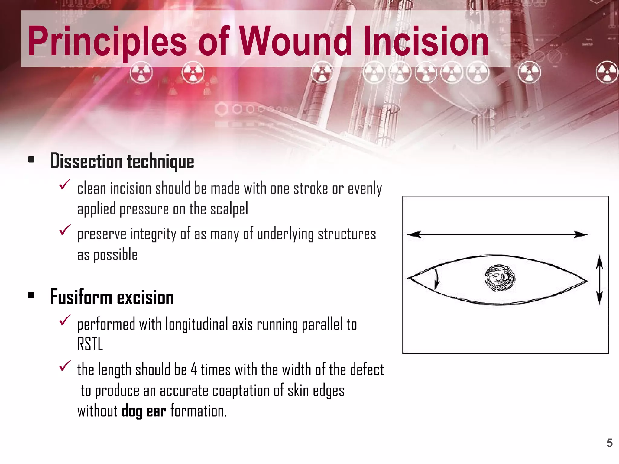 Principles of incision and wound closure | PPT